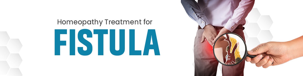 Different Types of Fistula: Causes, Symptoms & Prevention
